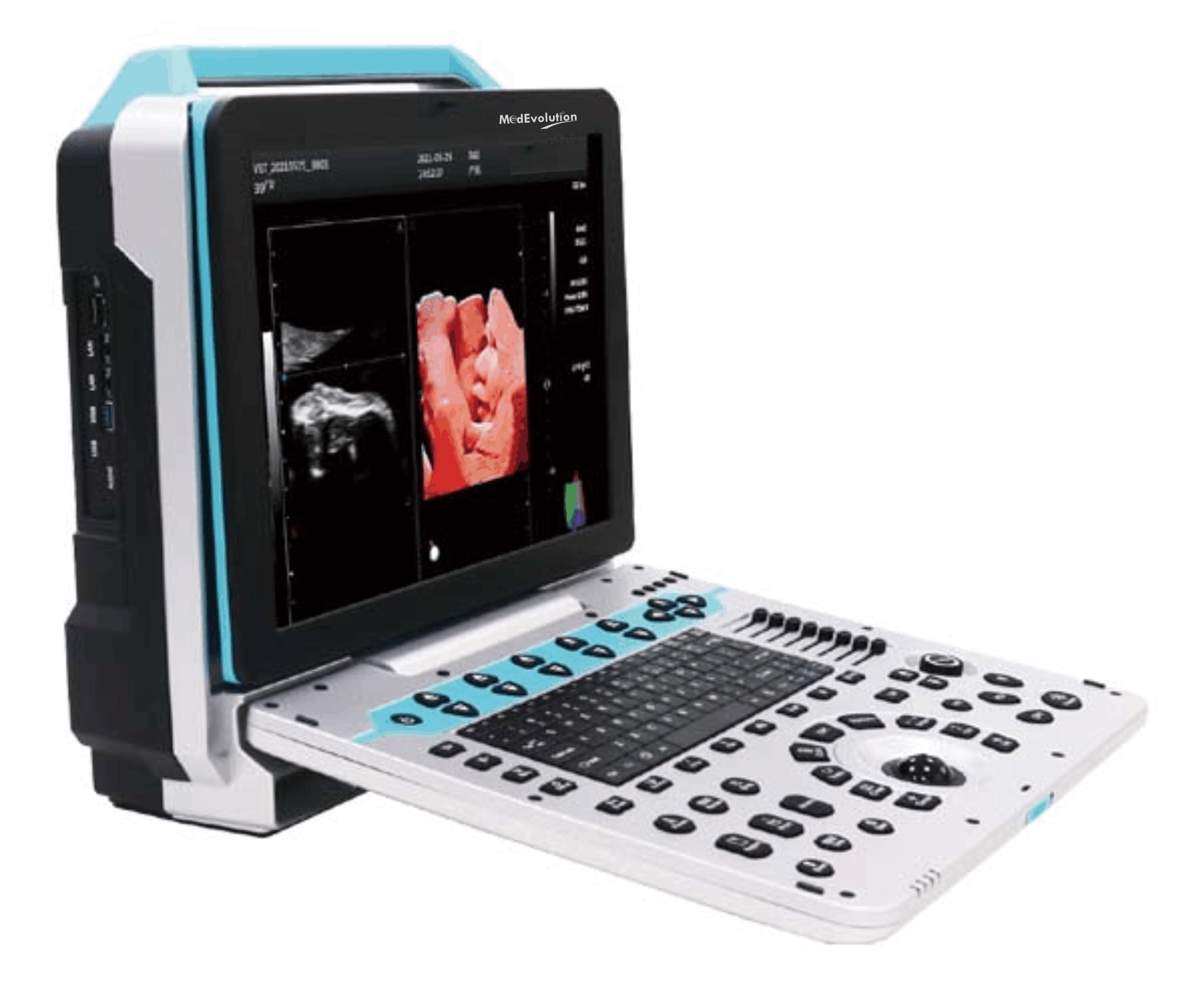 ME-P50(P5PRO) 4d/5d Medical Echo Portable Ultrasound Scan Machine ...