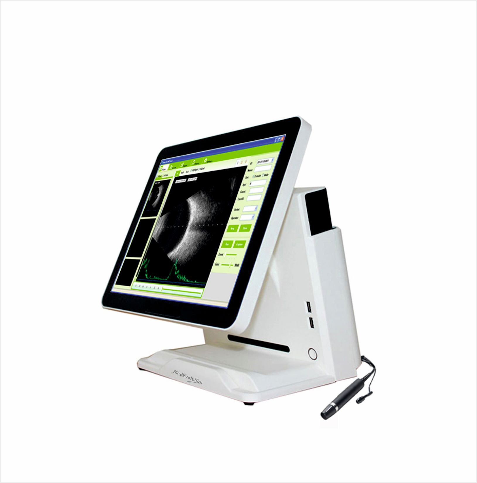 ME-500 Ophthalmic Ultrasound A/B Scan – Medevolutions