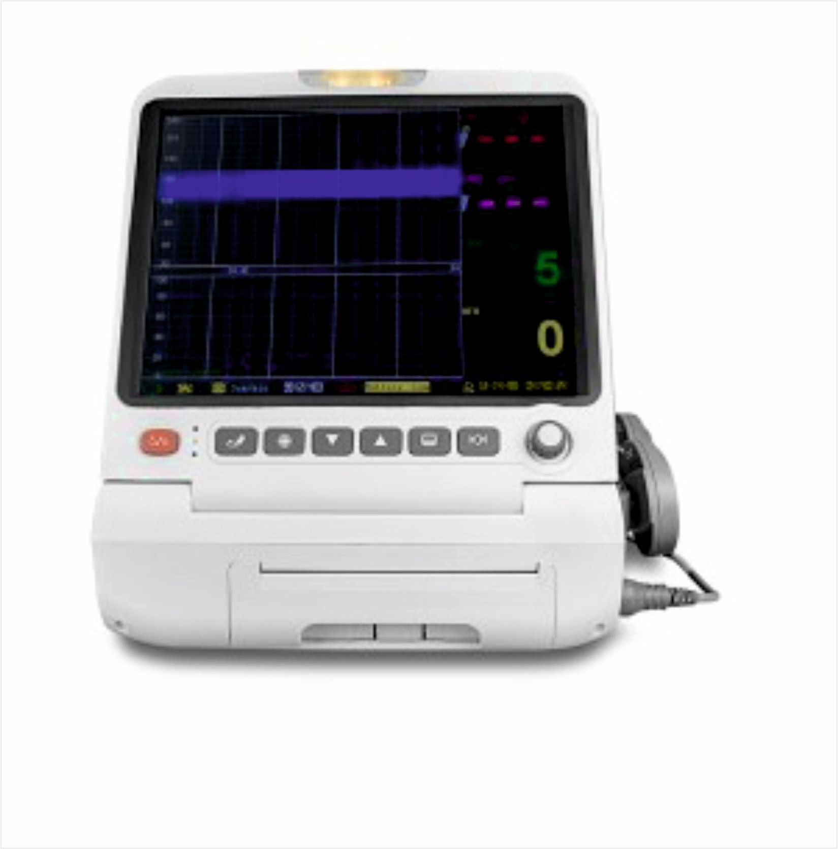 Fetal Monitor – Medevolutions